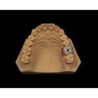 China Chrome Cobalt PFM Implant Screw Reusable Abutment 4.0mm Diameter Dental for sale