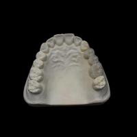 China Ceramic Powder PFM Crown Porcelain Fused to Metal Dental Restoration 1mm Thickness for sale