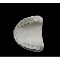 China Ceramic Powder PFM Crown Porcelain Fused to Metal Dental Restoration 1mm Thickness for sale