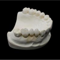 China Ceramic Powder PFM Crown Porcelain Fused to Metal Dental Restoration 1mm Thickness for sale