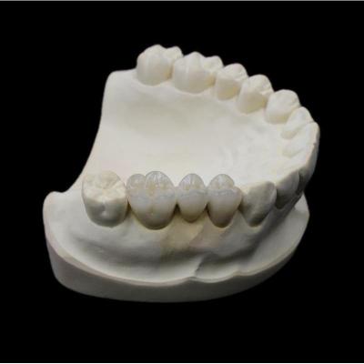 China Ceramic Powder PFM Crown Porcelain Fused to Metal Dental Restoration 1mm Thickness for sale