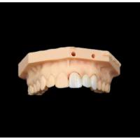 China Zircon Crown Dental Restoration 1200 MPa High Strength Natural Tooth Shade for sale
