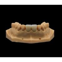 China Zircon Crown Dental Restoration 1200 MPa High Strength Natural Tooth Shade for sale