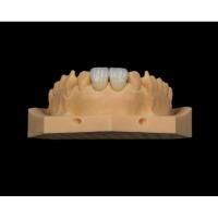 China Zircon Crown Dental Restoration 1200 MPa High Strength Natural Tooth Shade for sale