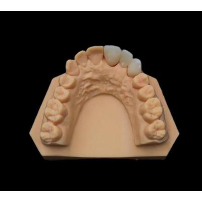 China Translucent Dental Zirconia Crown 7.5 Mohs Hardness High Strength Zircon Restoration for Digital Lab for sale