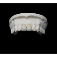 China High Translucency Dental Emax Crown 0.5mm Thickness for Esthetic Restorations for sale