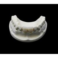 China High Translucency Dental Emax Crown 0.5mm Thickness for Esthetic Restorations for sale