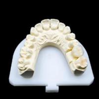 China High Translucency E max Inlay Dental Restoration 360MPa 400MPa Flexural Strength for sale