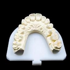 China High Translucency E max Inlay Dental Restoration 360MPa 400MPa Flexural Strength for sale