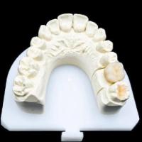 China High Translucency E max Inlay Dental Restoration 360MPa 400MPa Flexural Strength for sale