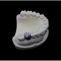 China FCC RICHMOND Chrome Cobalt Dental Crown for Space Restoration 1.0mm for sale
