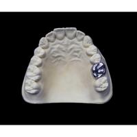 China FCC RICHMOND Chrome Cobalt Dental Crown for Space Restoration 1.0mm for sale