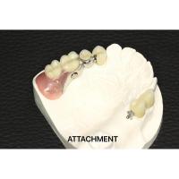 China Metal / Plastic Dental Attachment Denture Attachments Removable for sale