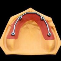 China Sandblasted Cad Cam Titanium Bar for Dental Laboratory Removable Denture Retention 30mm for sale