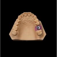 China Titanium Dental Implant Abutment 10mm Length Sandblasted Acid Etched Surface for sale
