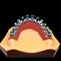 China Titanium Dental Implant Abutment 10mm Length Sandblasted Acid Etched Surface for sale