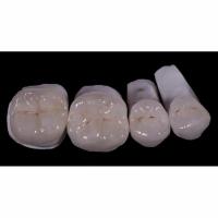 China Durable Composite Dental Crown for Die Preparation and Pontic Restoration 16mm for sale
