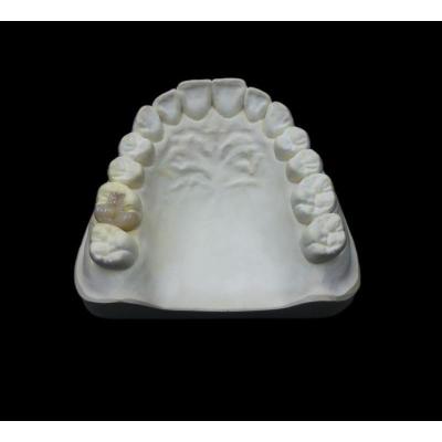 China Composite Resin Inlay for Small Cavity Restoration Dental Caries Treatment 2mm for sale