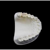 China Composite Resin Inlay for Small Cavity Restoration Dental Caries Treatment 2mm for sale