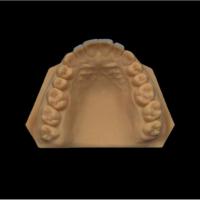 China High Durability Dental Veneers Natural Tooth Shade Glossy Surface 0.3mm Thickness for sale