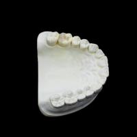 China Tooth Colored Dental Inlay Onlay High Wear Resistance Tooth Restoration 2mm for sale