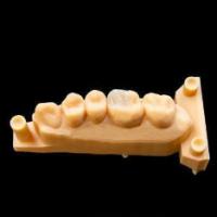 China Tooth Colored Dental Inlay Onlay High Wear Resistance Tooth Restoration 2mm for sale