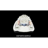 China Chrome Cobalt Dental Palate Prosthetics High Biocompatibility Corrosion Resistance 1.5mm Thickness for sale