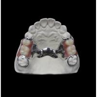 China Chrome Cobalt Dental Palate Prosthetics High Biocompatibility Corrosion Resistance 1.5mm Thickness for sale