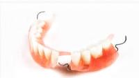 China Acrylic Partial Denture Clasp 0.8mm Wire for Secure Dental Applications for sale