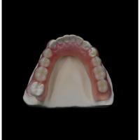 China Flexible Valplast Clasp Dental Clasp Secure Hold Denture Accessory 1.5mm for sale