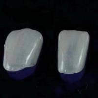 China Porcelain Tooth Veneer 0.3mm Minimally Invasive Stain Resistant for Cosmetic Dentistry for sale