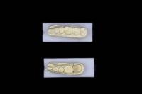 China Minimally Invasive Composite Inlay for Posterior Teeth Restoration 2mm Thickness for sale