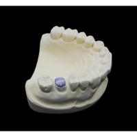 China Single Piece Post and Crown Restoration Dental Implant Post Core 1 Unit for sale