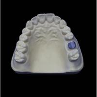 China Single Piece Post and Crown Restoration Dental Implant Post Core 1 Unit for sale