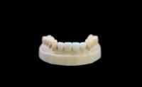 China Lithium Disilicate E.max Crown 360 MPa Flexural Strength All Ceramic Dental Restoration for sale