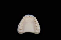 China Lithium Disilicate E.max Crown 360 MPa Flexural Strength All Ceramic Dental Restoration for sale