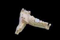 China High Hardness Zircon Crown Dental Restoration 1200 MPa Natural Tooth Shade for sale
