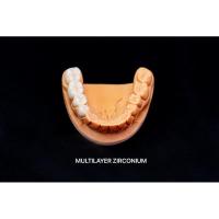 China Zirconia Dental Crown 1200 MPa High Translucency Digital CAD CAM Milling Block for Posterior Anterior Restoration for sale