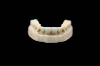 China Lithium Disilicate E Max Crown All Ceramic Dental Restoration 360 MPa Flexural Strength for sale