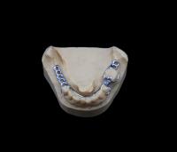 China CAD CAM Dental Metal Framework Chrome Cobalt Palate Partial Denture Base 1.5mm for sale