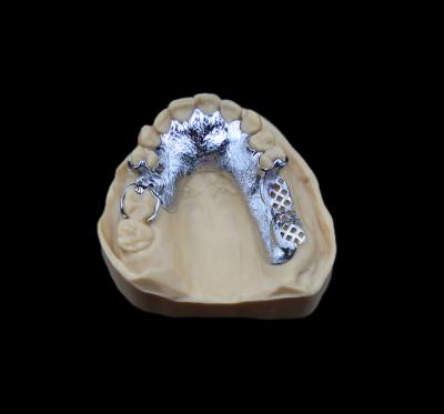 China Corrosion Resistant Cast Metal Framework Partial CAD CAM Fit 0.5mm Thickness for sale