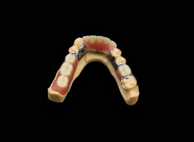 China Nickel Chromium CCP Framework Dental Lab China Metal Framework Partial for sale