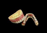 China Nickel Chromium CCP Framework Dental Lab China Metal Framework Partial for sale