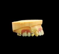 China Medical Acrylic Denture Base High Biocompatibility PMMA Resin 100g Pink for sale
