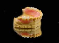 China Dental Lab China Prosthesis Valplast Denture Flexible Partial Denture Biocompatible for sale