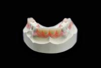 China Metal Free Valplast Denture Flexible Removable Partial Dentures for sale