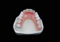 China Metal Free Valplast Denture Flexible Removable Partial Dentures for sale