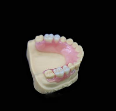 China Flexible Partial Denture Biocompatible Nylon Resin Metal Free High Flexibility 1950s for sale