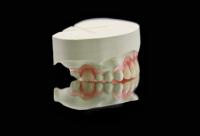 China Flexible Partial Denture Biocompatible Nylon Resin Metal Free High Flexibility 1950s for sale