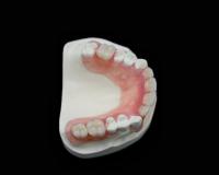 China China Dental Outsourcing Valplast Partial Denture Biocompatible Nylon Resin Flexible 1950s for sale